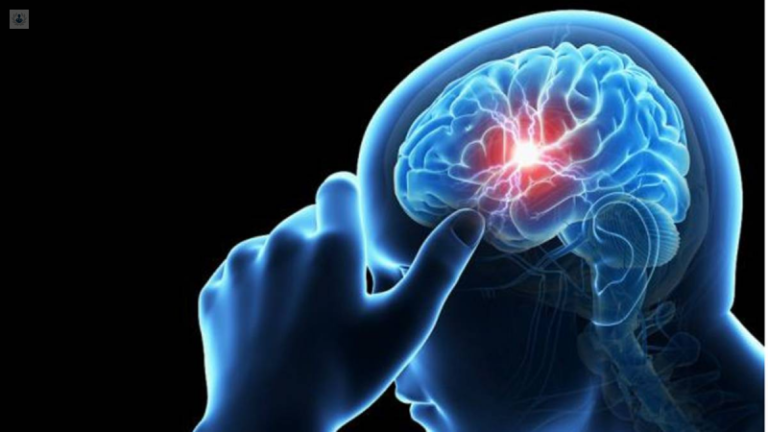 Aneurisma Cerebral Causas Síntomas Y Tratamientos Remedios Caseros